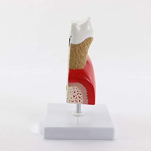 Dental Model Detachable Human Molar Model: El modelo dental perfecto ...